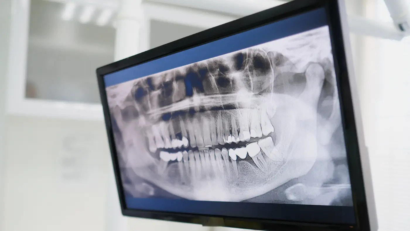 X-Ray – hbradiology